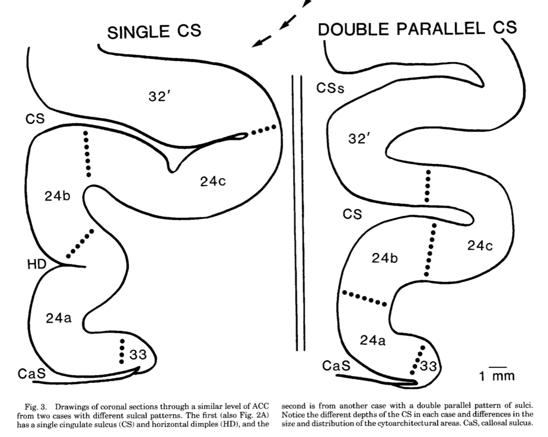Anterior Cingulate Practice And Theory Of Brain Imaging